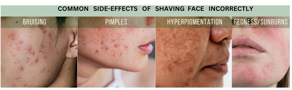 Causes of Hyperpigmentation After Shaving Upper Lips - Hair Fai